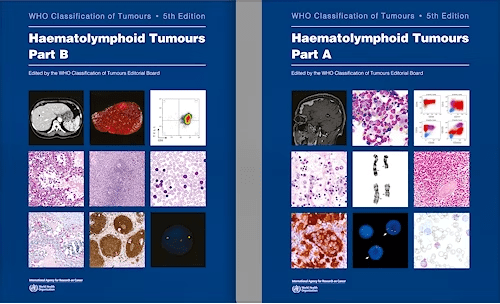 WHO Classification of Tumours: Haematolymphoid Tumours. Part A and Part ... WHO Classification of Tumours: Haematolymphoid Tumours. Part A and Part ...